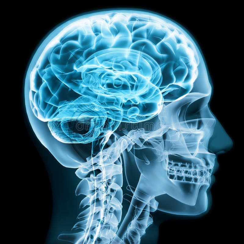X-ray Close Up with Brain and Skull Stock Illustration - Illustration ...