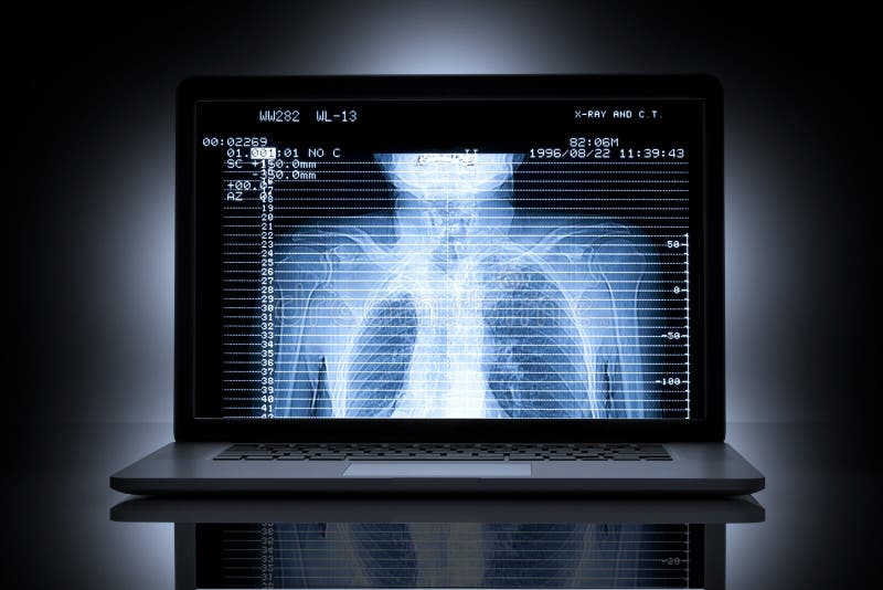 X-Ray CT Scan Computer Healthcare Stock Photo - Image of technology ...