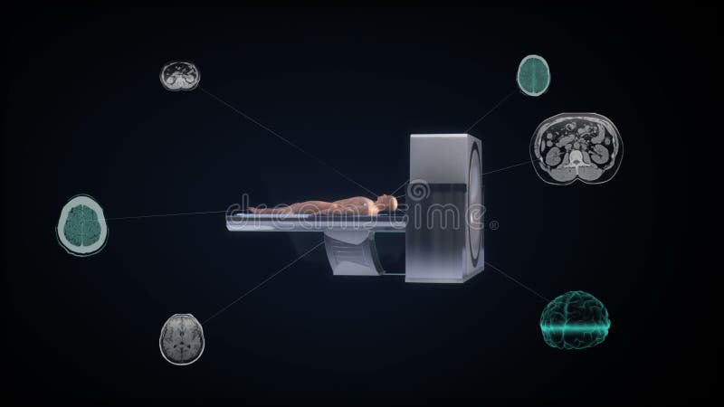 X-ray CT Scanner, Medical Diagnosis Technology.MRI,white.1 Stock Video ...