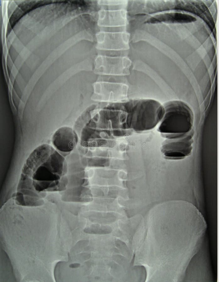 X-ray diagnostics stock image. Image of obstruction, diagnostics - 7760379