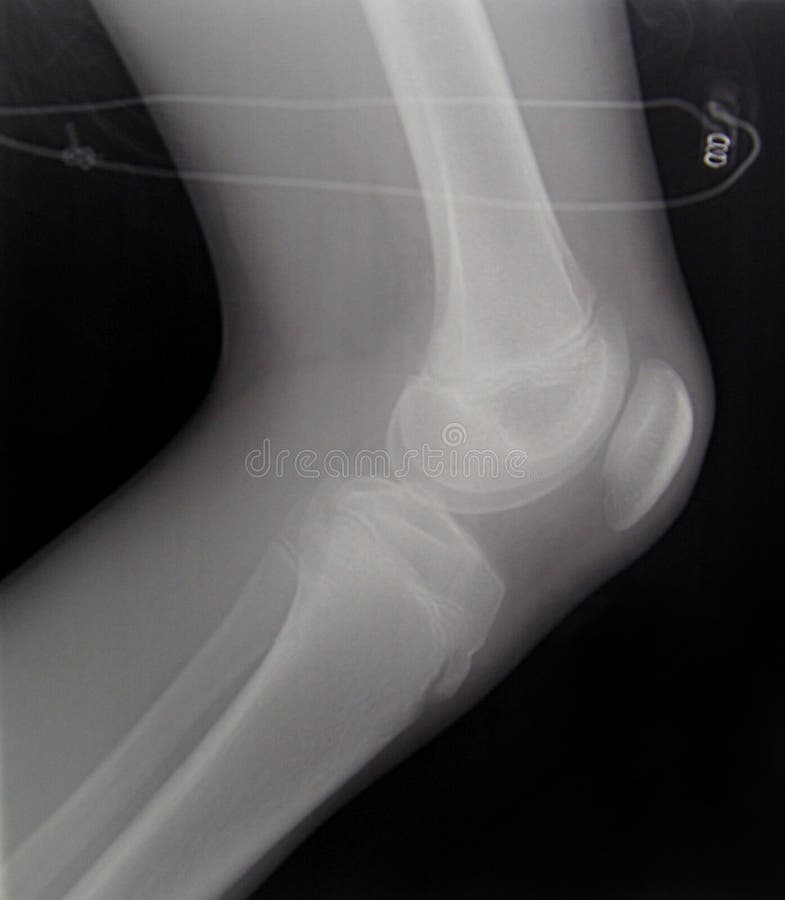 X-ray Diagnostics/knee Picture. Image: 8194008
