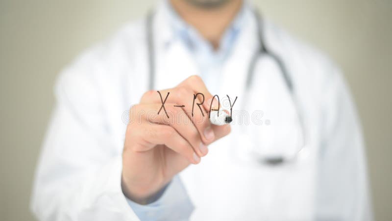 X-ray image of the hands stock image. Image of doctor - 39536847