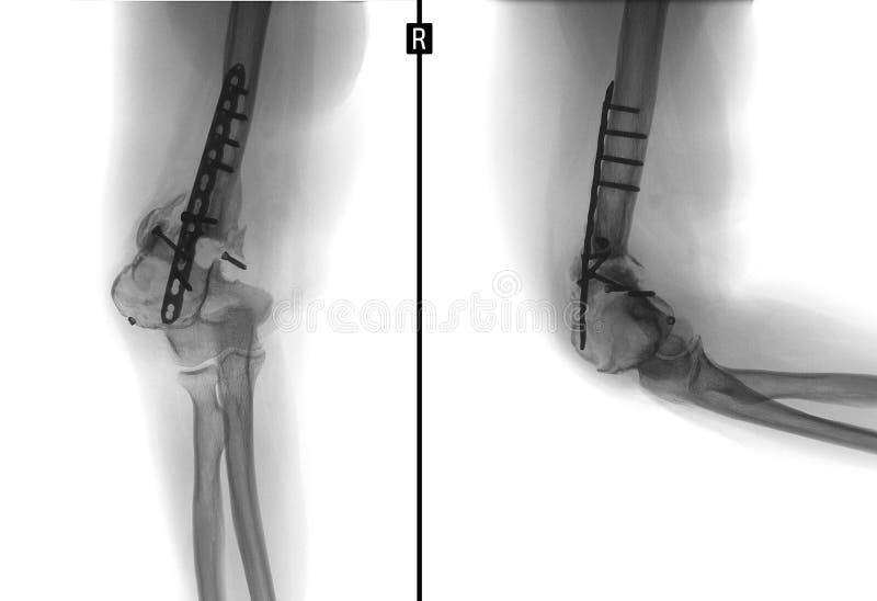 136 Callus Anatomy Stock Photos - Free & Royalty-Free Stock Photos from ...