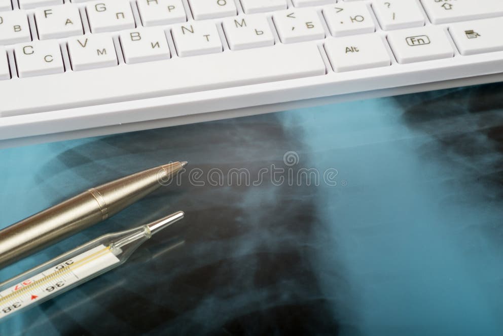 X-ray Examination and Keyboard Stock Photo - Image of keyboard, ribs ...
