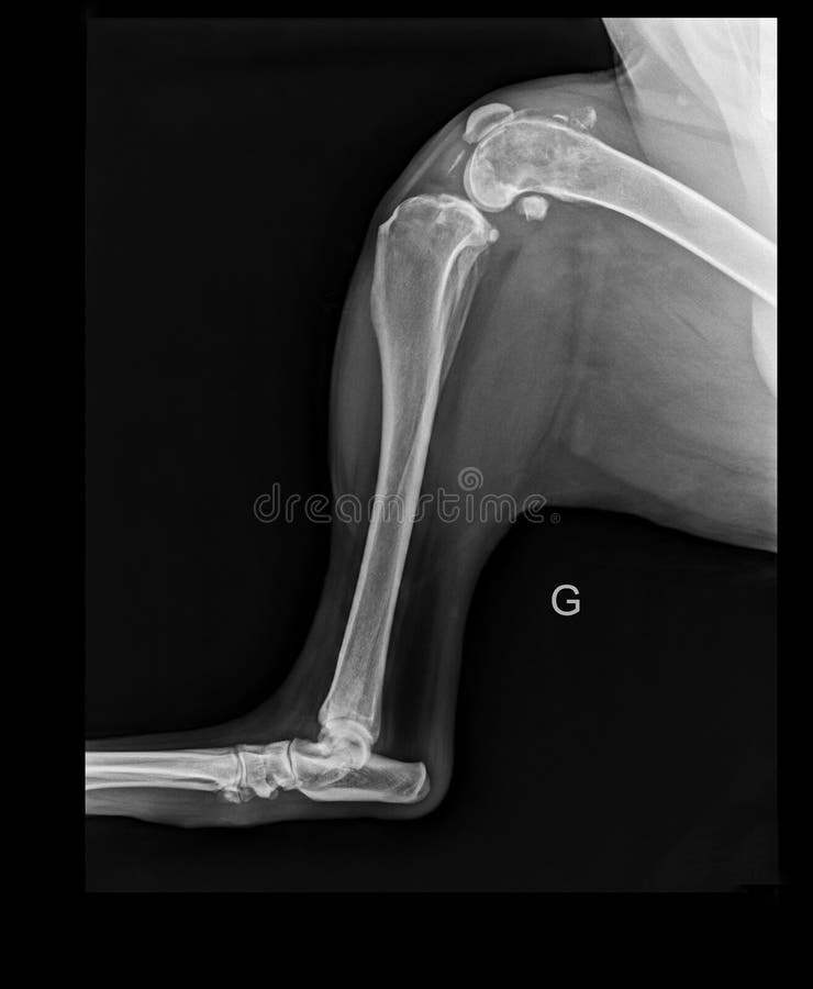 Dog Thighbone Sarcoma X-ray Stock Image - Image of body, radiology ...