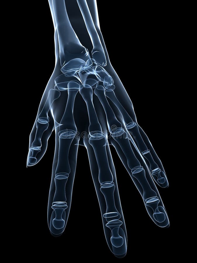 X Ray Hand Stock Illustrations – 5,075 X Ray Hand Stock Illustrations ...
