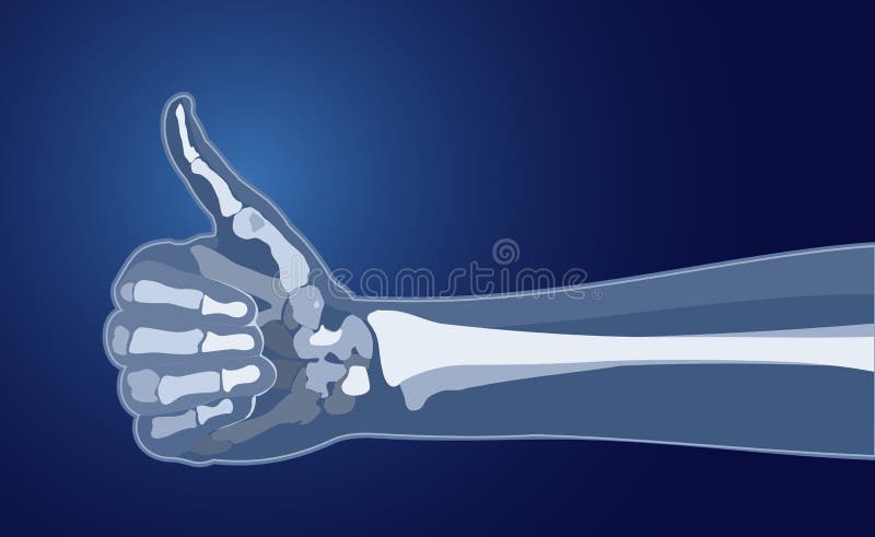Xray Cartoon Hand