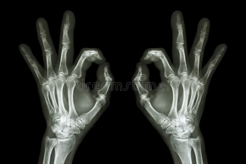 Skeleton Hand Ok Sign Stock Photos - Free & Royalty-Free Stock Photos ...