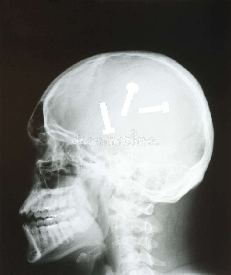 5,678 Head Bolts Stock Photos - Free & Royalty-Free Stock Photos from ...