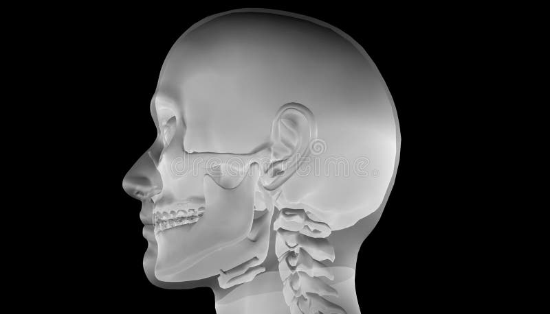 X-Ray of Human Head stock illustration. Illustration of radiology - 2322620
