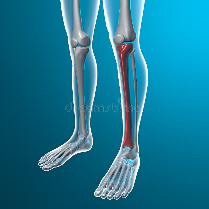 X-ray of Human Legs, Tibia Bone Stock Illustration - Illustration of ...
