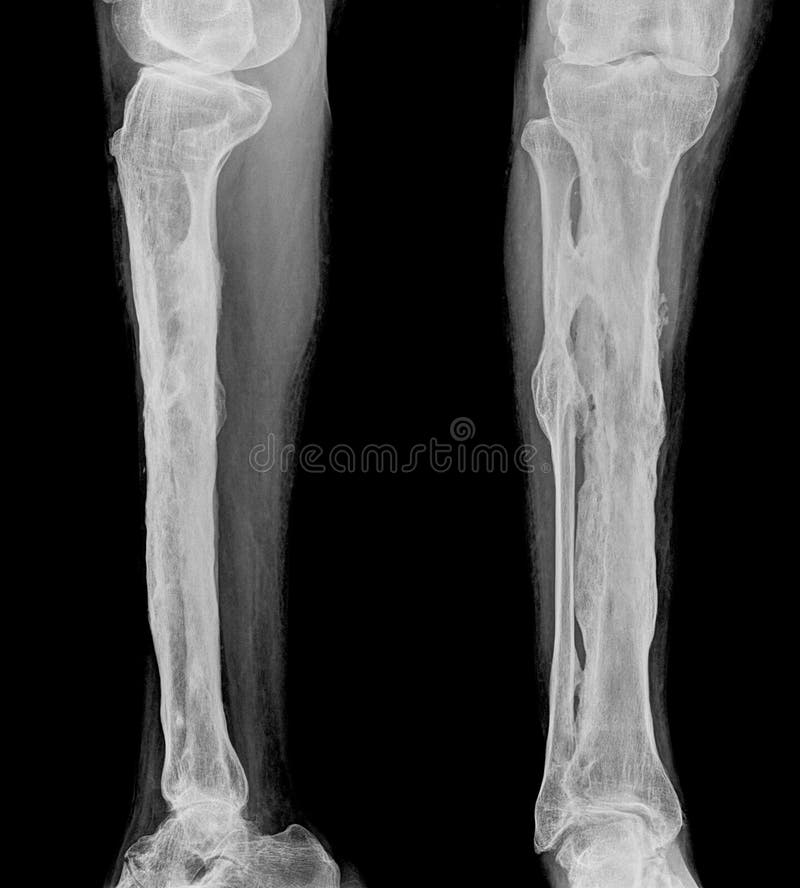 X-ray stock image. Image of roentgen, medical, healthcare - 54697509