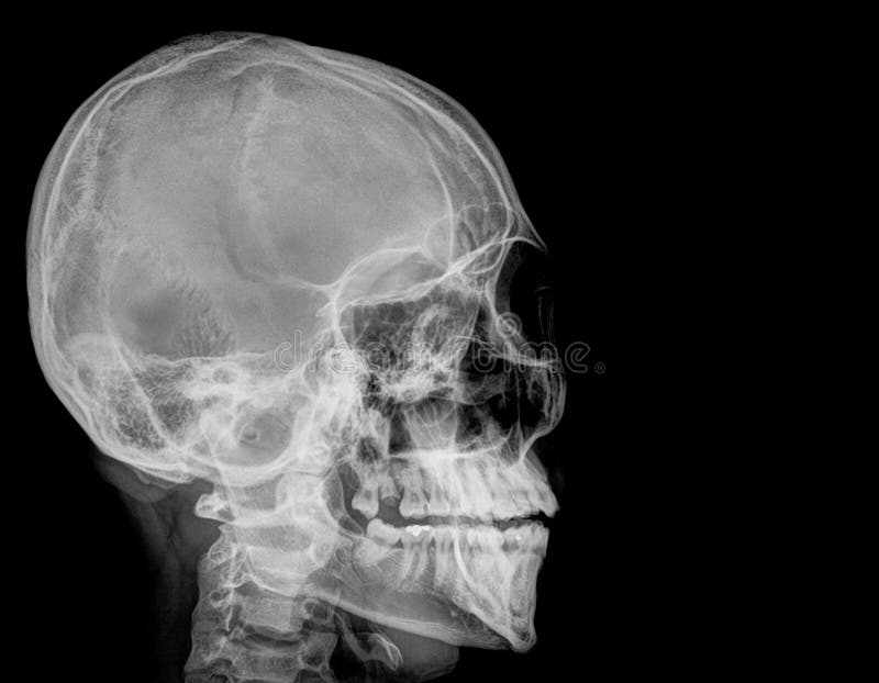 238 X Ray Profile Stock Photos - Free & Royalty-Free Stock Photos from ...
