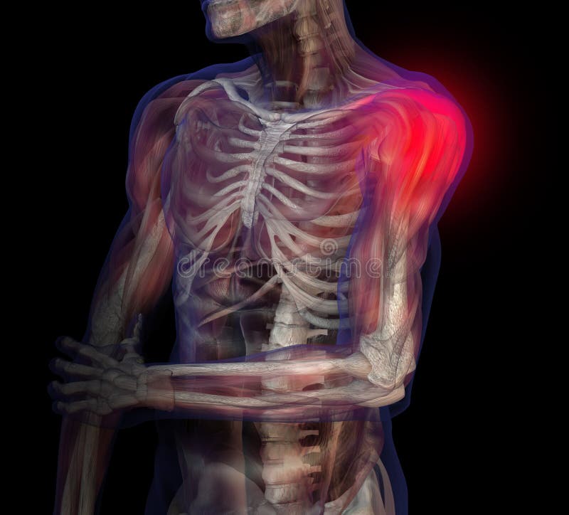 Shoulder pain stock vector. Illustration of muscle, injury - 34614001