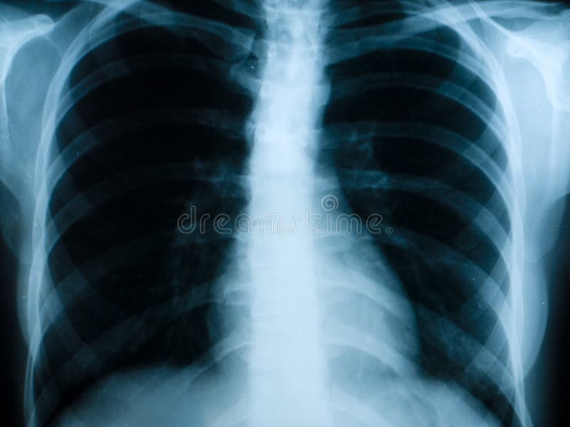 X-ray Image stock image. Image of scan, isolated, white - 8305529