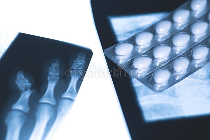 X-ray Image and Blister Pack of White Tablets Stock Photo - Image of ...