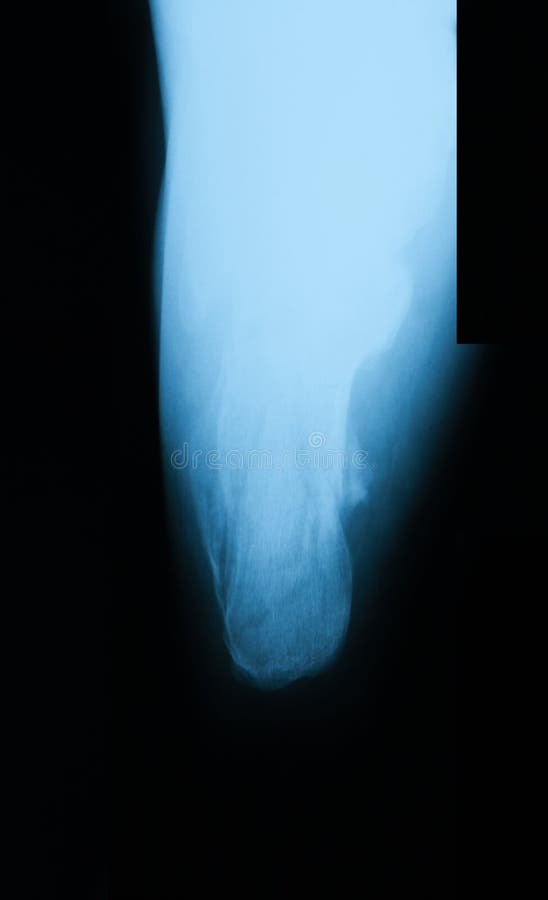 Axial View Stock Images - Download 91 Royalty Free Photos