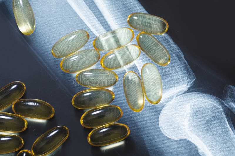 X-ray Image and Capsules of Fish or Krill Oil Stock Image - Image of ...