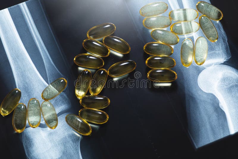 X-ray Image and Capsules of Fish or Krill Oil Stock Photo - Image of ...