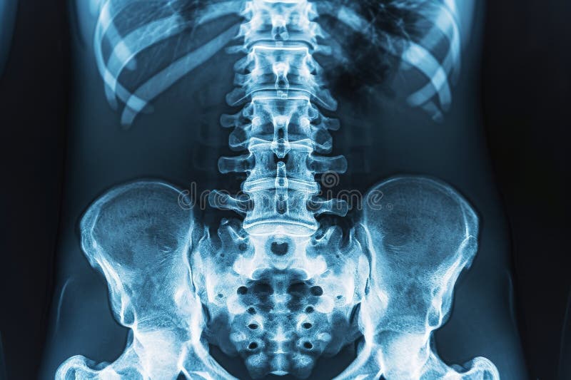 An X-ray Image Capturing the Back of a Man with a Visible Skeleton ...