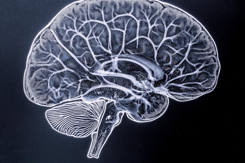 X-ray Image of the Human Brain Stock Image - Image of psychology ...