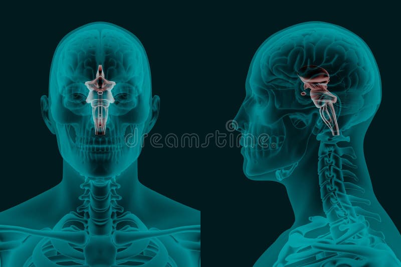 X-ray Image of the Human Brain Stem in Frontal and Lateral Projections ...