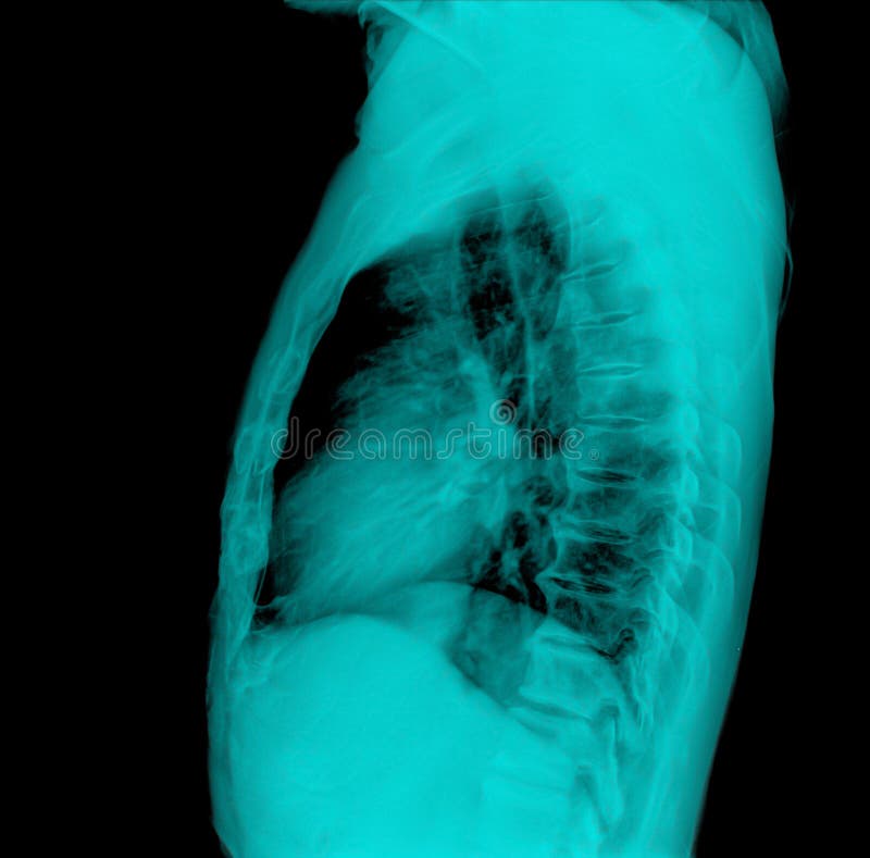 202 Back View Human Heart Stock Photos - Free & Royalty-Free Stock ...