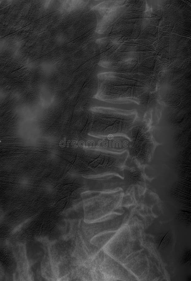 Backbone stock photo. Image of details, anatomy, radiology - 307452626