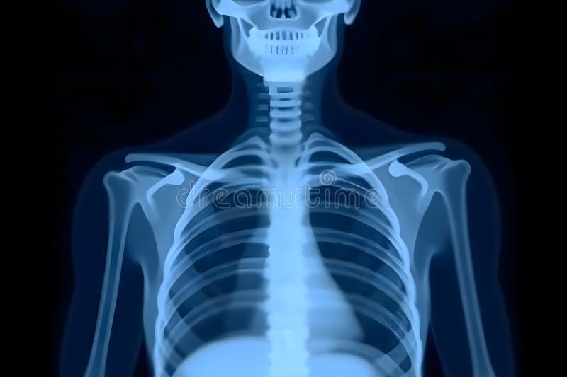An X-ray Image of the Human Respiratory System Created by AI Stock ...