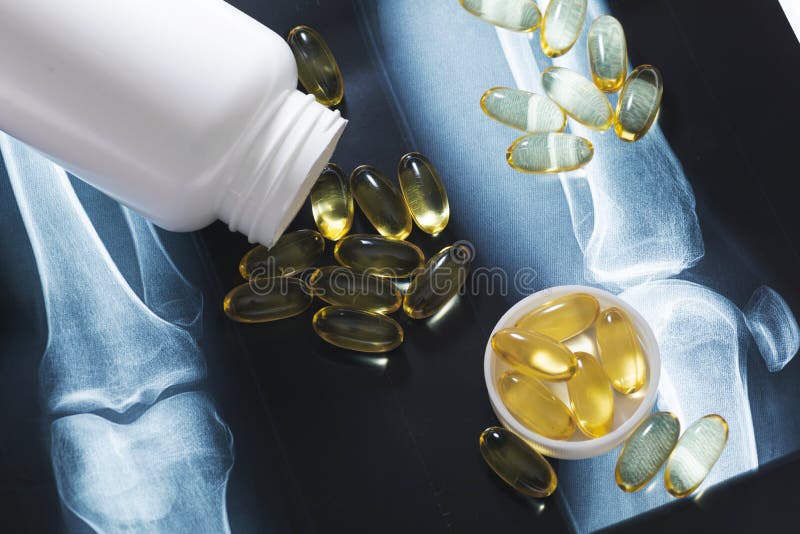 X-ray Image and Jar with Fish or Krill Oil Capsules Stock Photo - Image ...