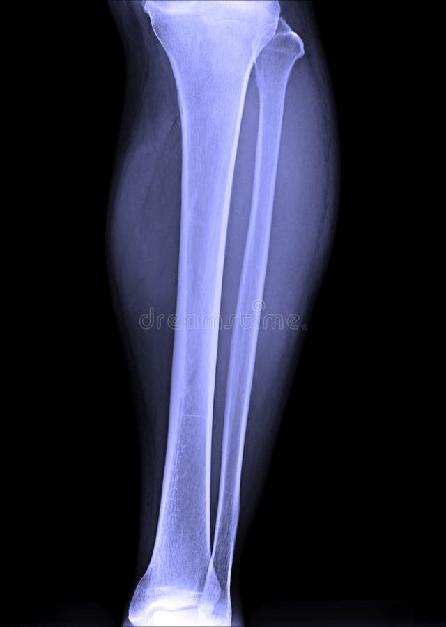 Male Body Anatomy Front Side Stock Photos - Free & Royalty-Free Stock ...