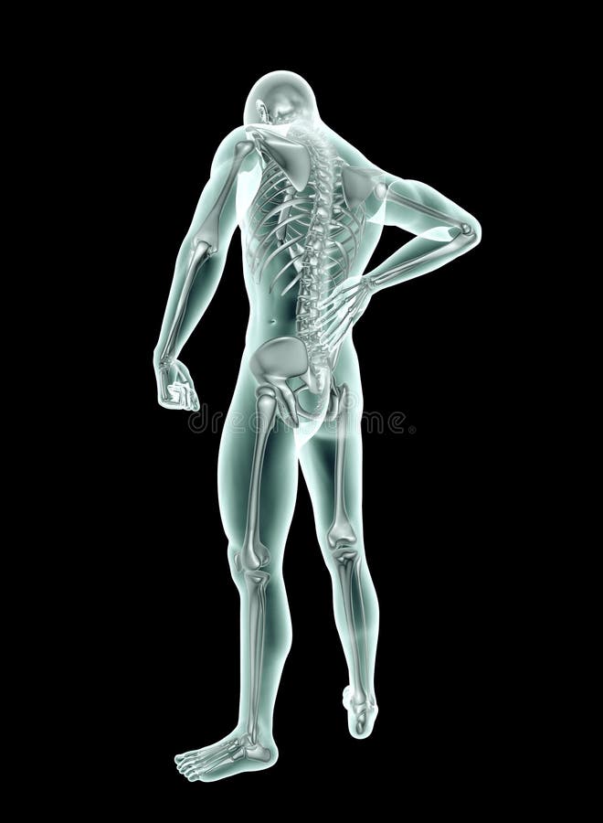 X-ray Image Man with Back Pain with Clipping Path Stock Illustration ...