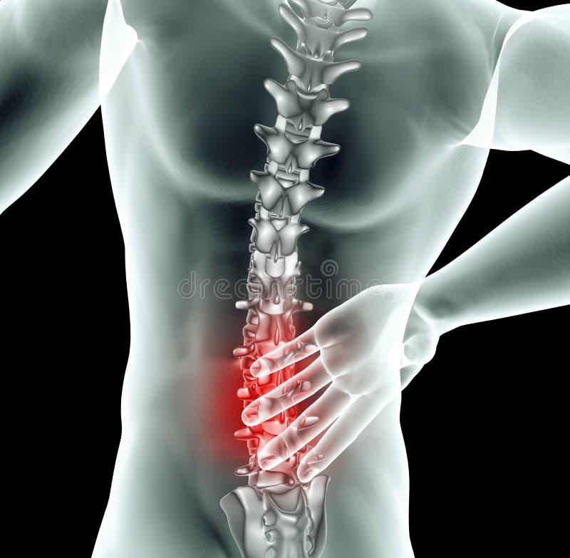X-ray Image Man with Back Pain with Clipping Path Stock Illustration ...