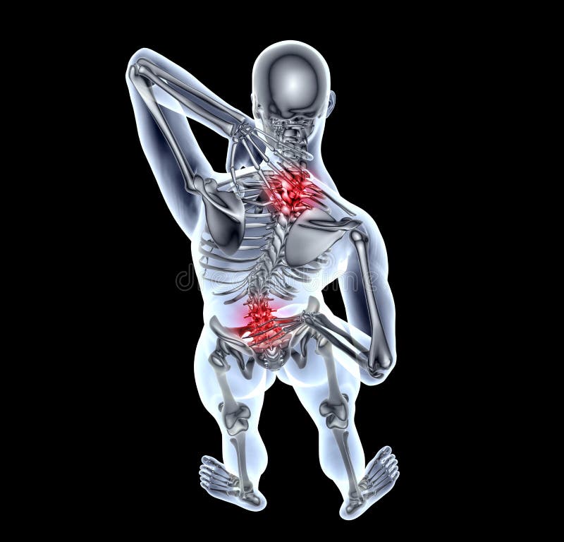 X-ray Image Man with Back Pain with Clipping Path Stock Illustration ...