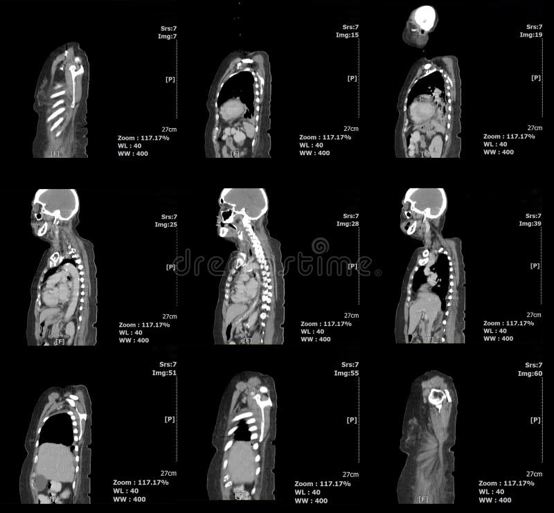 X Ray Image Mri Scan Stock Image Image Of Cancer Scan 297003303