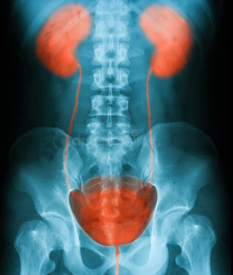 X Ray Kub Stock Photos Pictures Royaltyfree Images