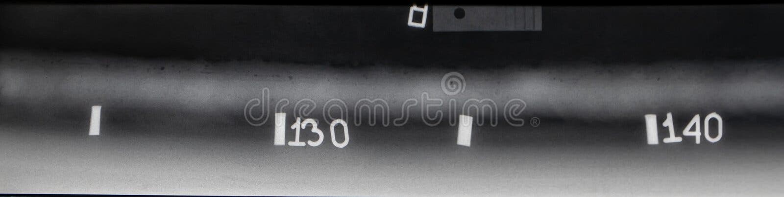 X-ray Image of the Welding Seam with Defects Stock Photo - Image of ...
