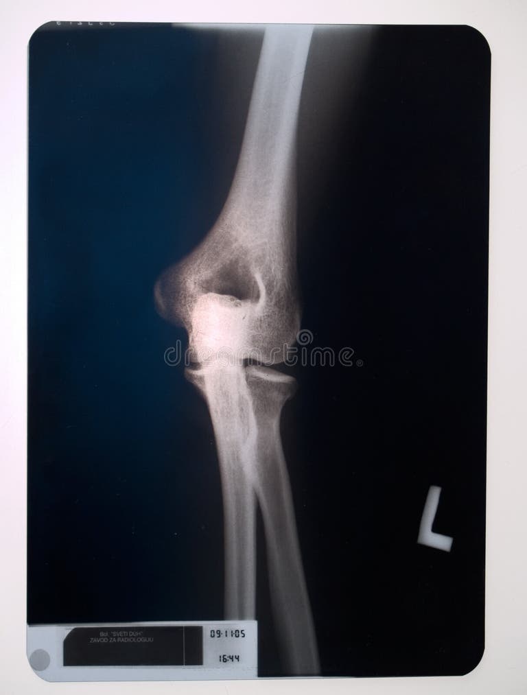 1,537 Ray Mysterio Photos Stock Photos - Free & Royalty-Free Stock ...