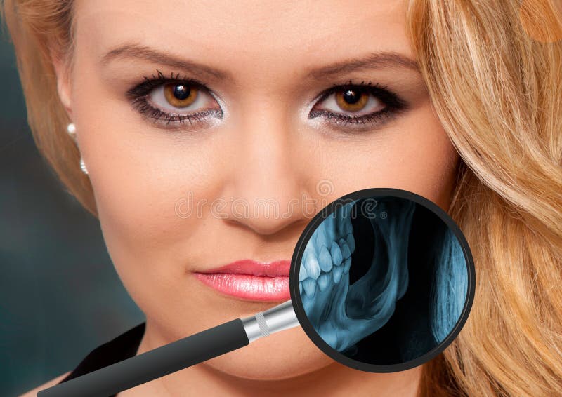 X-ray with a Magnifying Glass from the Visual Field of a Person`s Jaw ...