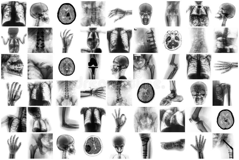 X-ray Multiple Part of Human and Many Medical Condition and Disease ...