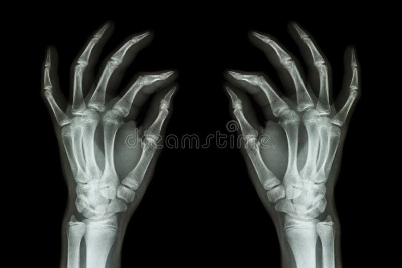 870 Human Palm Surgery Stock Photos - Free & Royalty-Free Stock Photos ...