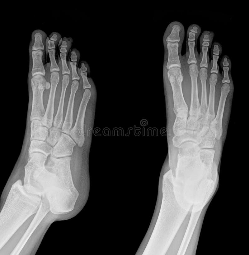 X-ray stock image. Image of biology, body, pain, health - 54697463