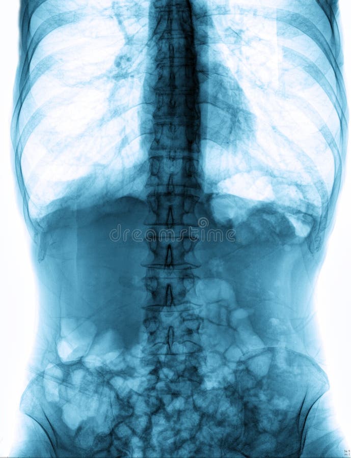 X-ray stock image. Image of injury, radiology, radiological - 31199899