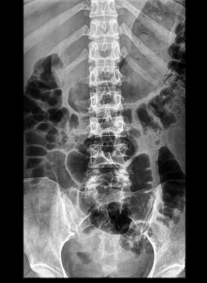 X-ray stock photo. Image of radiological, test, xray - 31202274