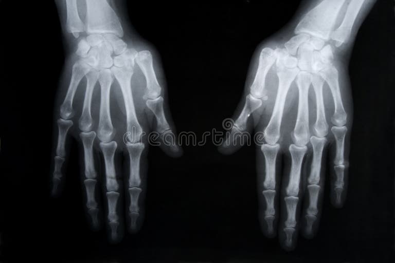 691 Human Body Radiograph Stock Photos - Free & Royalty-Free Stock ...