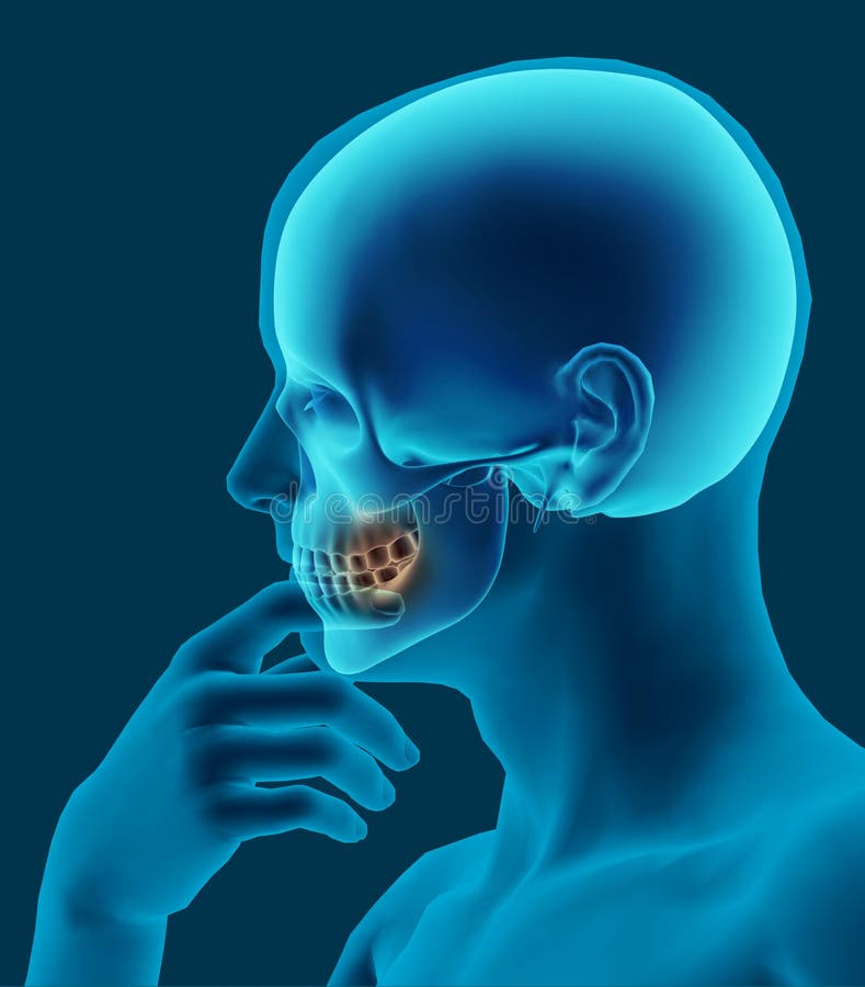 X-ray Picture of a Man with a Toothache Stock Illustration ...