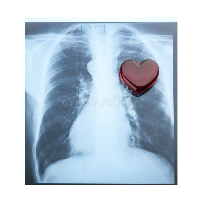 X-ray Red Heart of Human on White Background. Stock Image - Image of ...