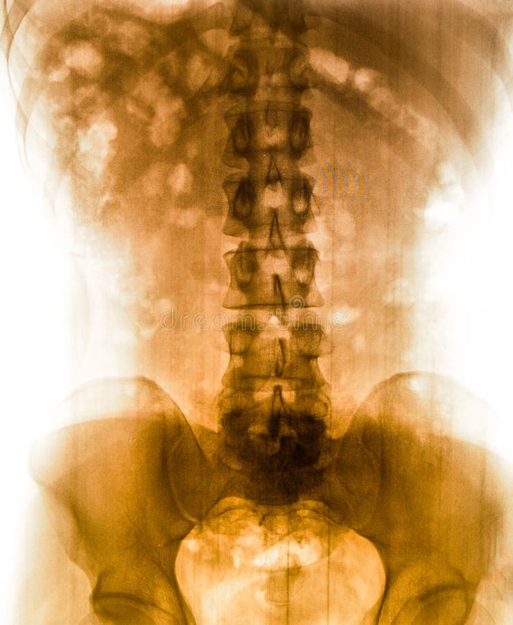 X-Ray scan human stock image. Image of radiology, head - 49682959