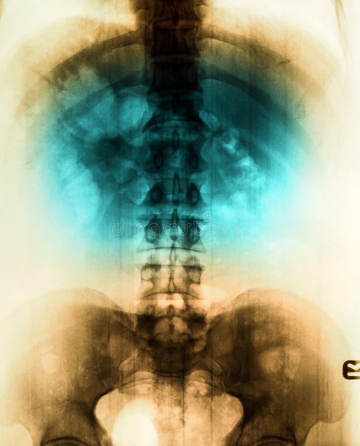 X-Ray scan human stock image. Image of skeleton, medical - 42767673