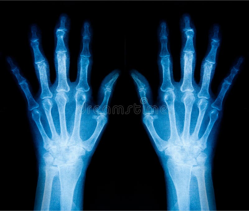 X-Ray scan human stock image. Image of film, medical - 42767977